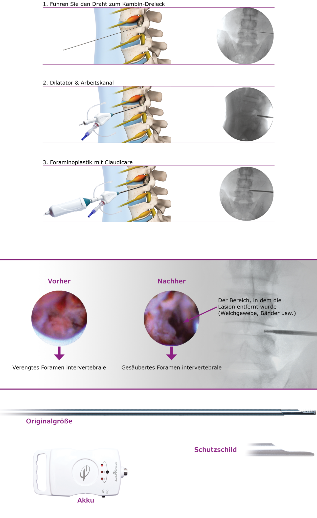 ClaudiCare – HBE HealthCare