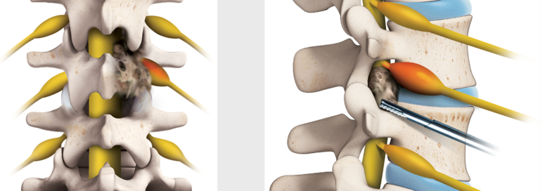 ClaudiCare – HBE HealthCare